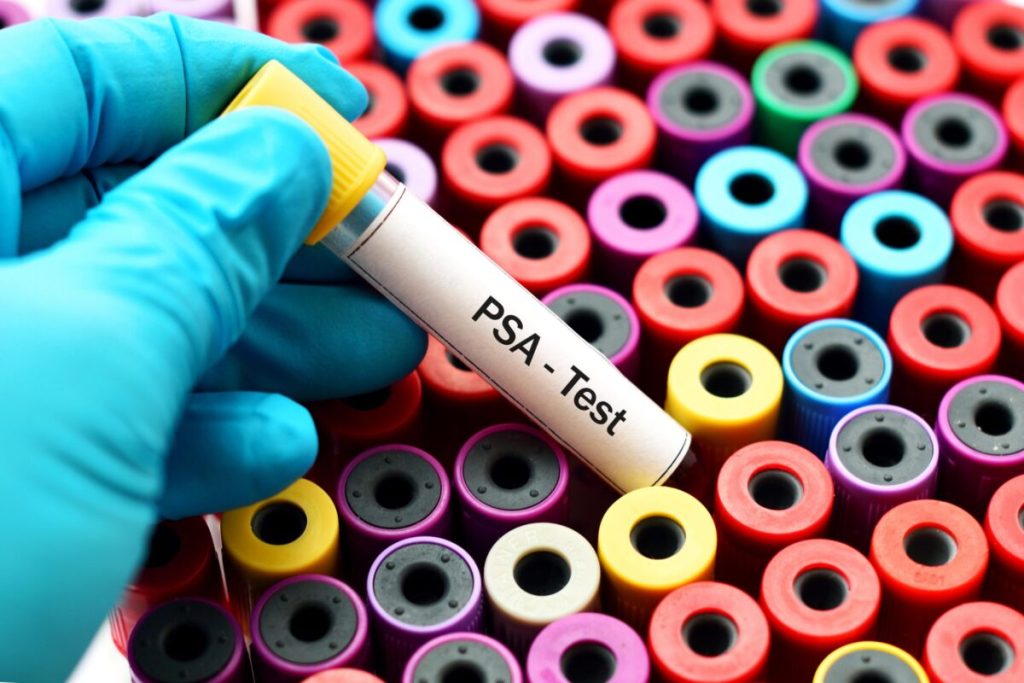 Welsh charity calls for live-saving prostate cancer screening – The ...
